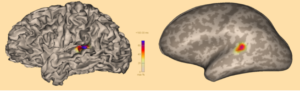 ERP/EP – Event related Potentials / Evoked Potentials - Brain Vision
