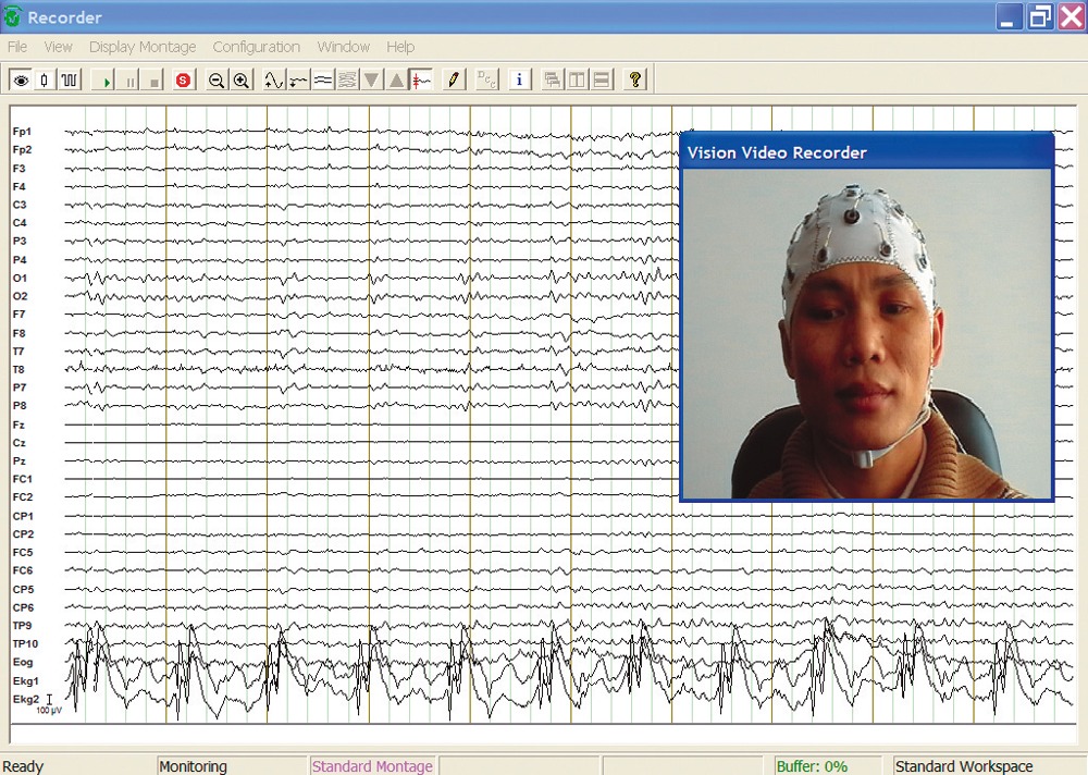 fNIRS - Brain Vision