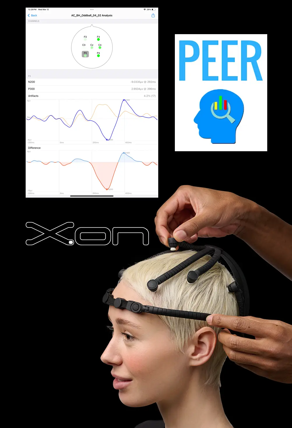 Education - Brain Vision
